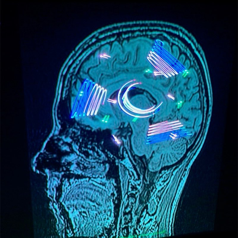 2020 ILDA Award Laser Photography entries